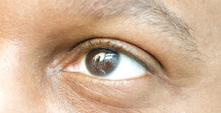Minor Eye Conditions Service (MECS) | Healthwatch Bury